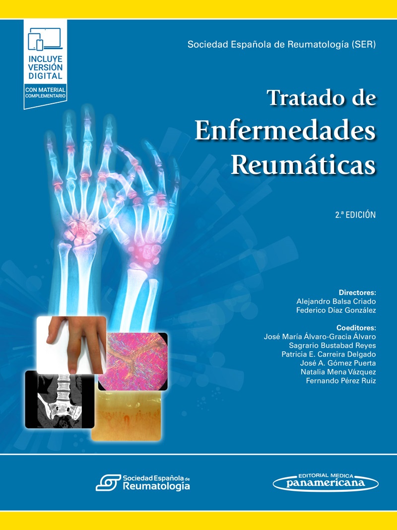 Tratado de Enfermedades Reumáticas SER Sociedad Española de ...