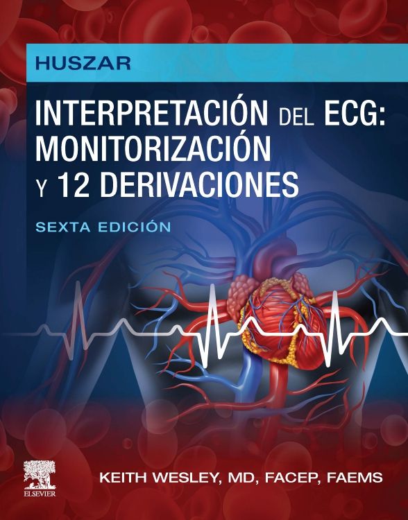 Huszar. Interpretación del ECG: monitorización y 12 derivaciones 6 ...