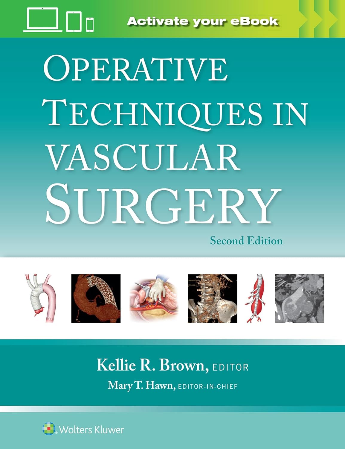 Operative Techniques in Vascular Surgery Edition: 2 - Author(s): Kellie ...