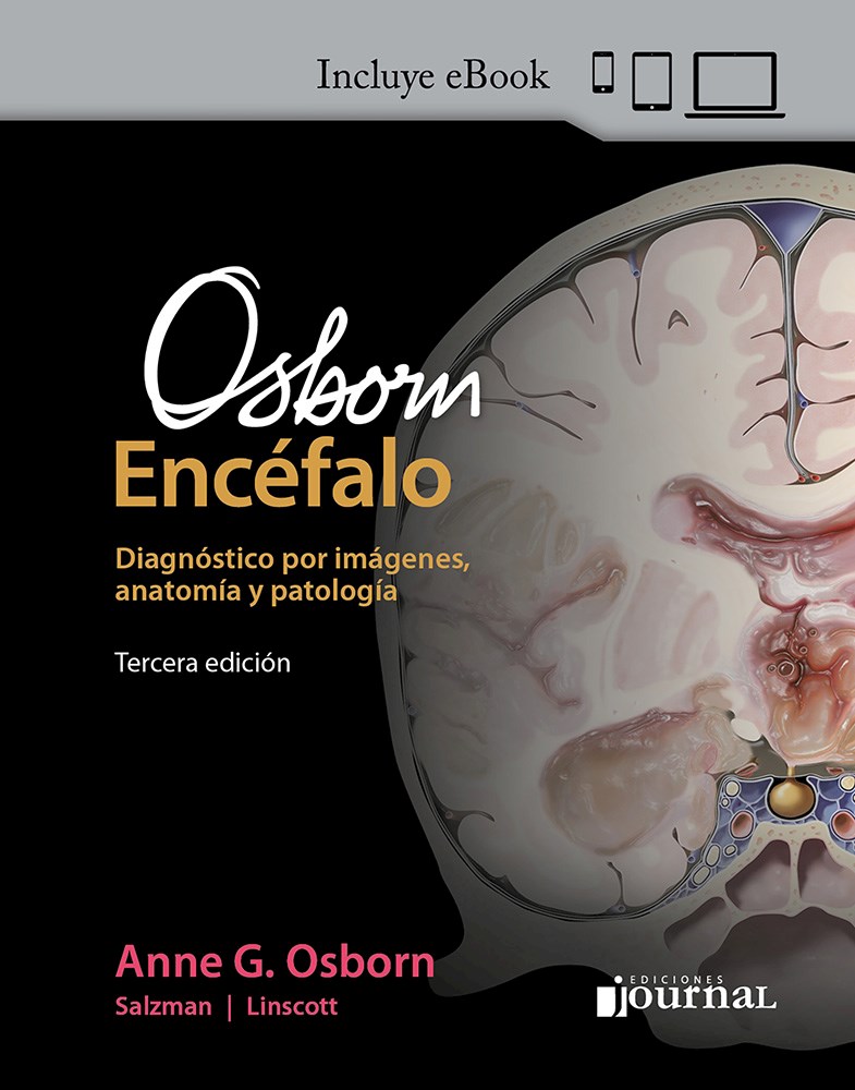 Osborn. El Encéfalo Ed.3 2025/ Autores: Karen L. Salzman Luke L ...